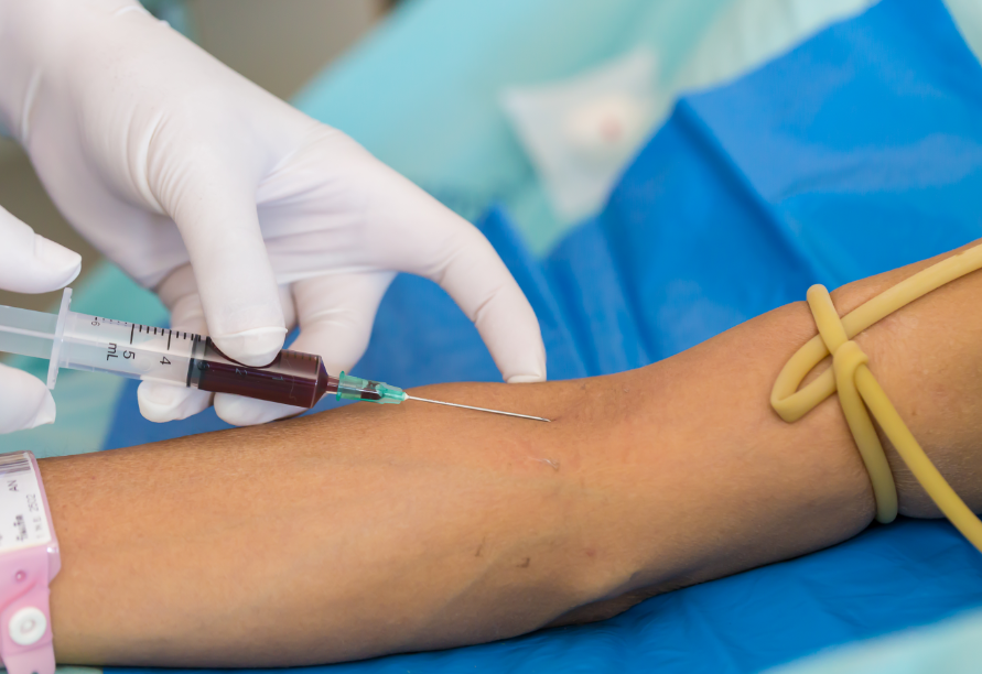 PSA: entenda a importância desse exame - Dr. Paulo Maron